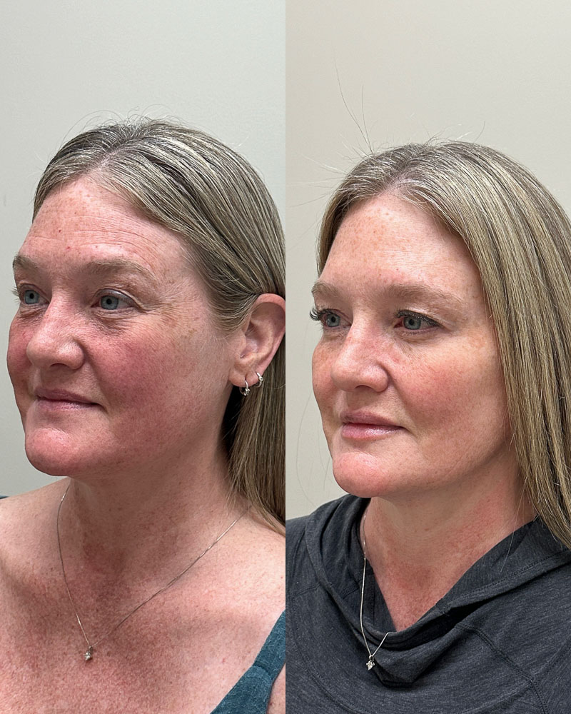 Dry vs. Dehydrated Skin: How to Tell What Your Skin Really Needs | The ...