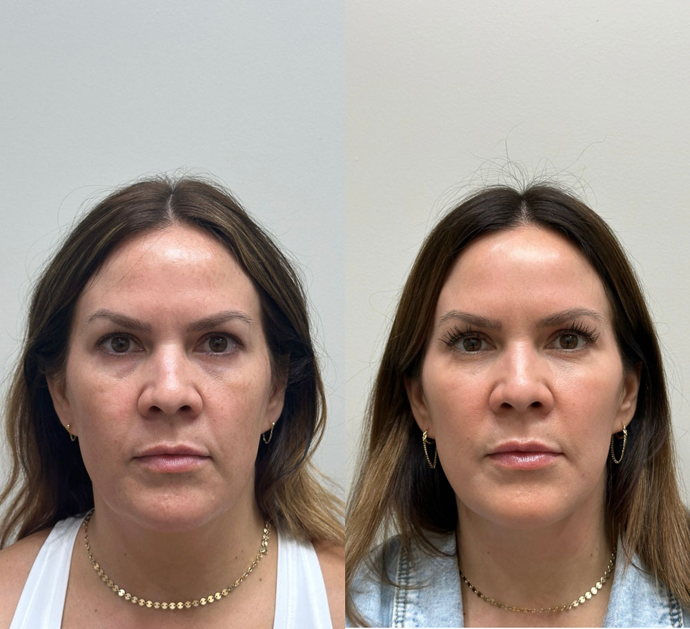 Dry vs. Dehydrated Skin: How to Tell What Your Skin Really Needs | The ...